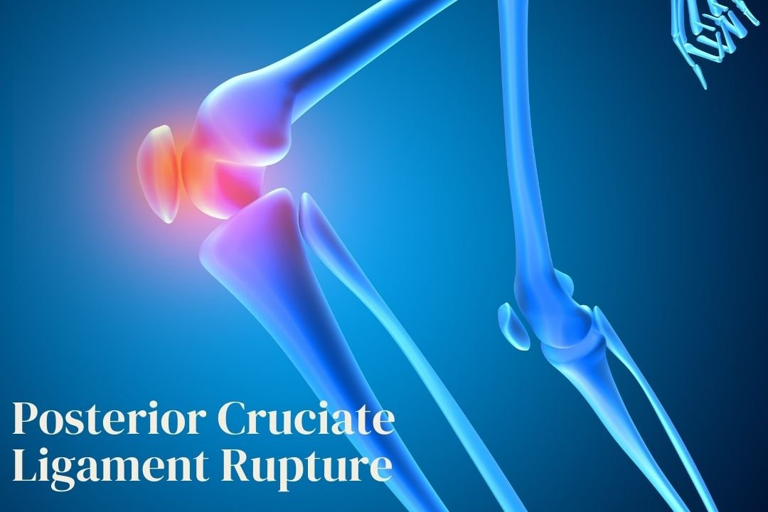 Learn More about Causes, Symptoms, and Treatment Options for ...